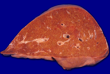 BASF Launches Hepaxa as First Dedicated Product in the U.S. To Help ...