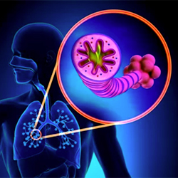 FDA Approves Breyna, First Generic of Symbicort to Treat Asthma and COPD