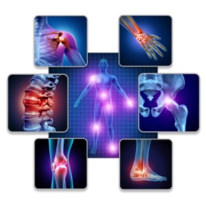 FDA Approves New Formula for Hadlima, Biosimilar to Humira