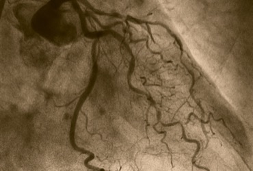 Taking Repatha Data to Heart Boosts Rx Class