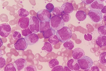 Key Treatment Principles and Recent Updates In the Management of ...